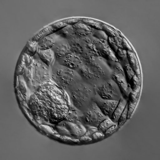 Blastocyst Culture · Long Embryo Culture Selection | IVFforYOU