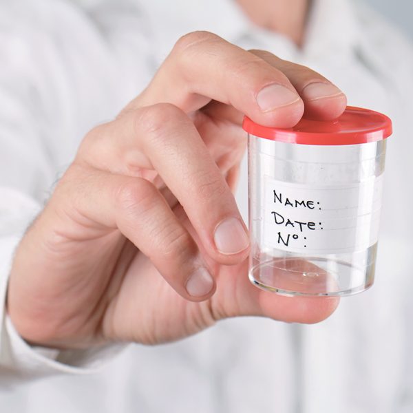 Spermiogram: Semen Test for Sperm Analysis | IVFforYOU