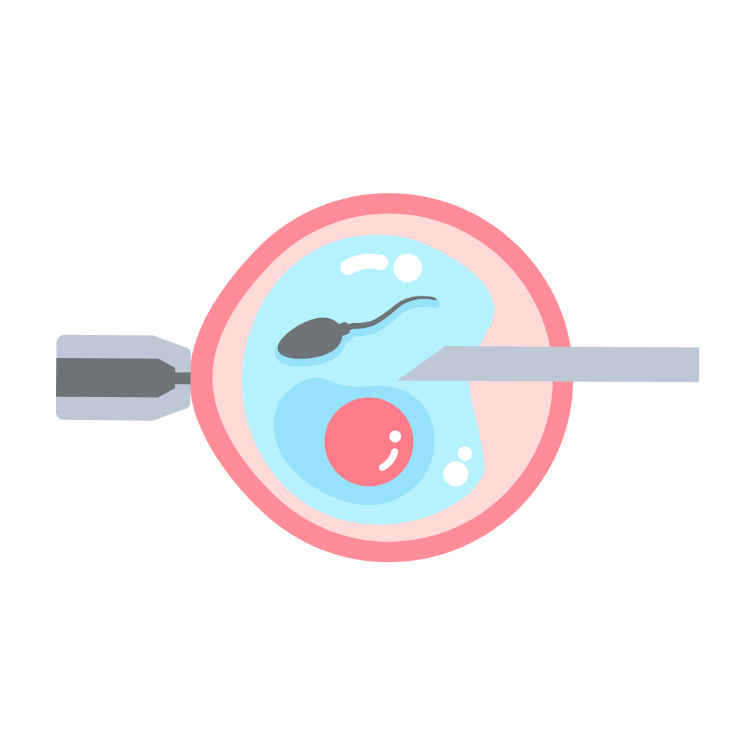 ICSI: What it is and why it has better success rates | IVFforYOU