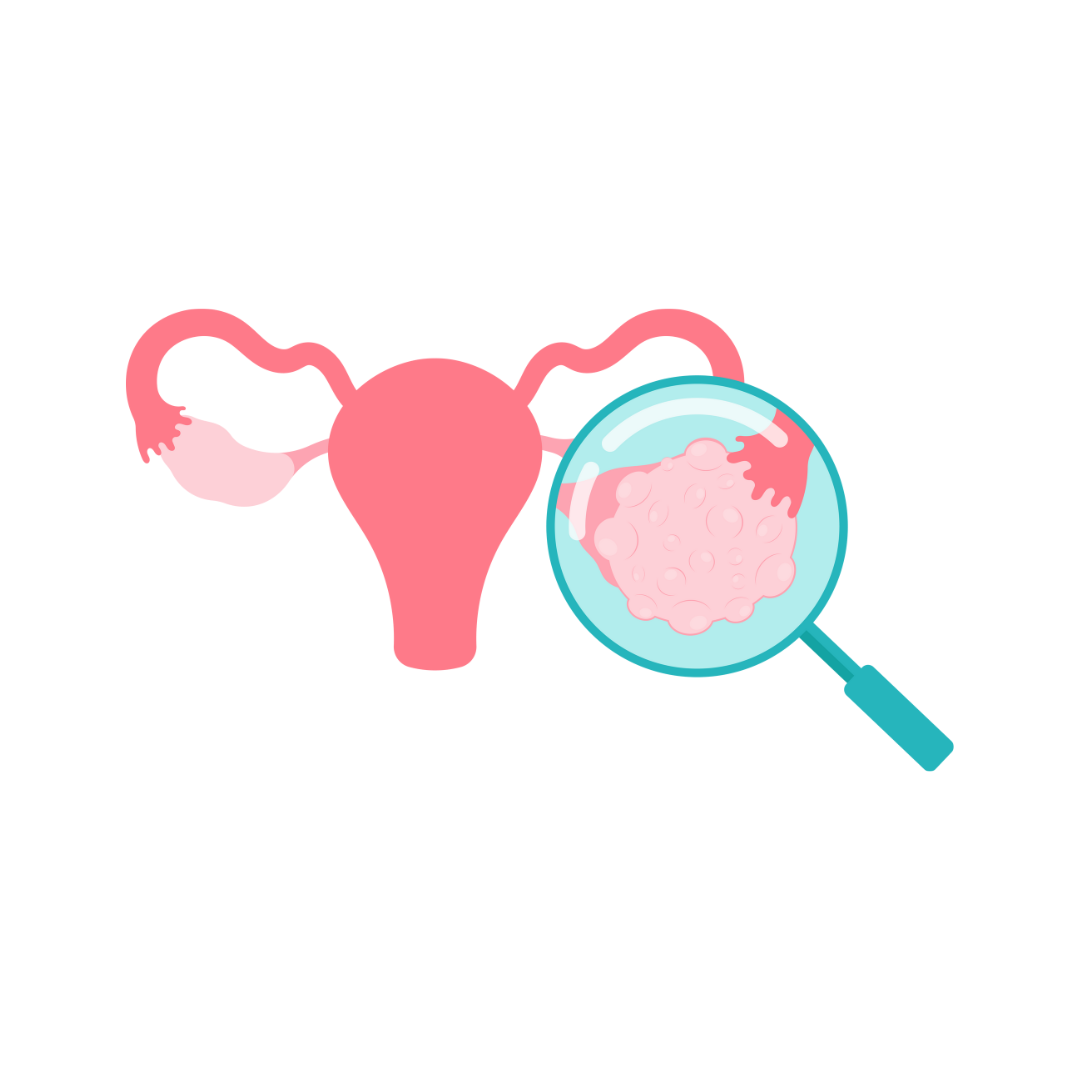 Ovarian stimulation: Phases and side effects | IVFforYOU